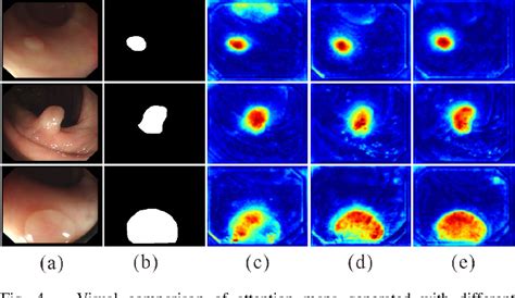 Figure 4 From Meta Unet Multi Scale Efficient Transformer Attention