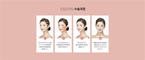 꼬집리프팅 눈도 리프팅도 아이팅성형외과