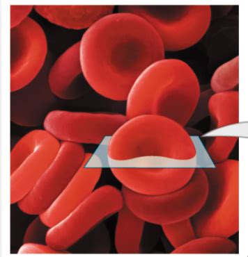 Lab 9 Flashcards Quizlet