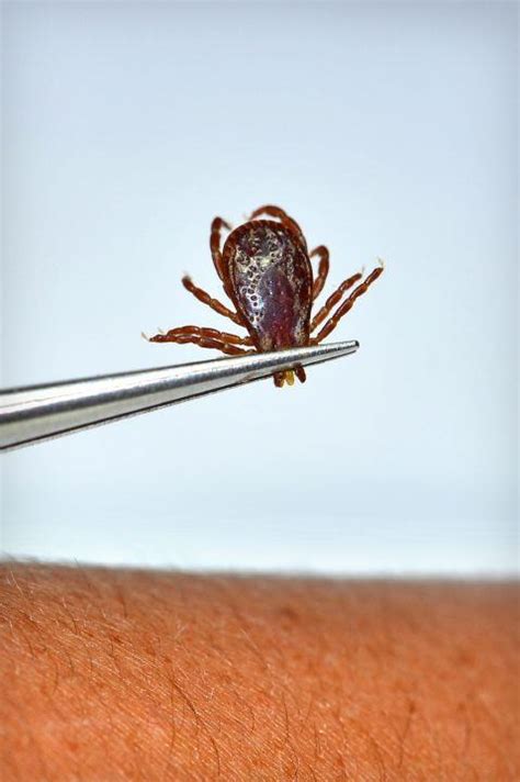 A Cautionary Tale Of Ticks South Shore Press