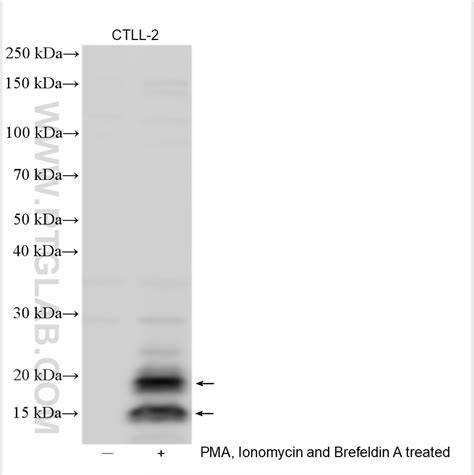 Ifn Gamma Antibody 29788 1 Ap Proteintech