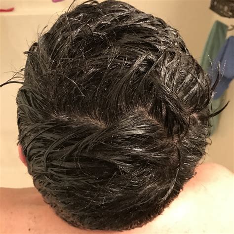 DIY Dry Scalp Treatment Essentially Sammie