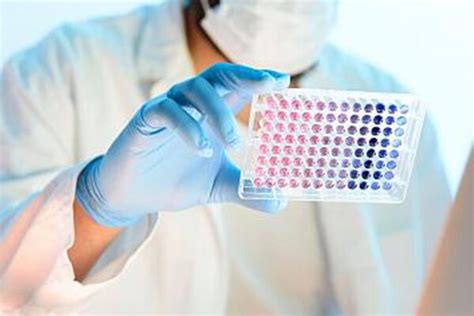 How To Calculate ELISA Assay Values By EXCEL ELISA Tests