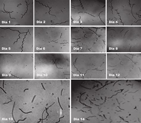 Estructuras Espirales De Arthrospira Platensis A Diferentes Tiempos Download Scientific Diagram