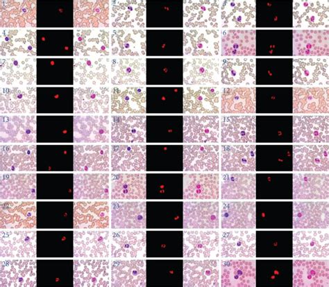 The Results Of Segmentation Of Leukocytes By This Method Download