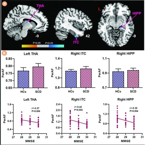 Relationships Between The Gmv And Mmse In Subjective Cognitive Decline