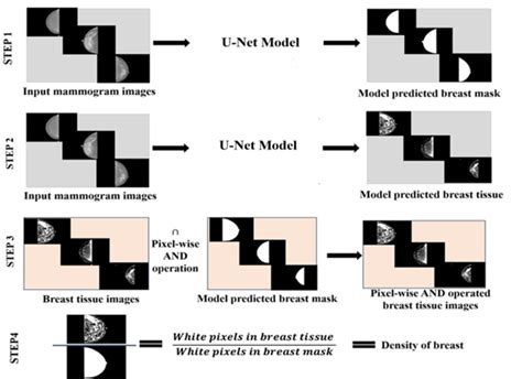Segmentation Of Breast Tissues And Classification Of Breast Based On Breast Tissue Density