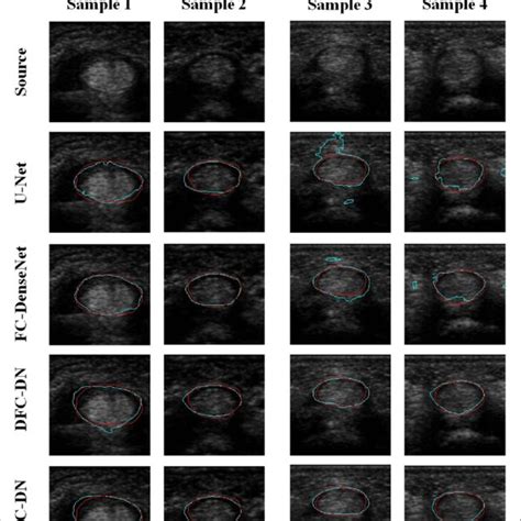Segmentation Results Of Tendon And Synovial Sheath Images Download Scientific Diagram