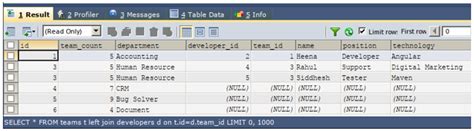 Left Join Vs Right Join Top Differences Between Left Join Vs Right Join