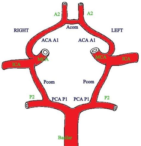 The Circle Of Willis Is The Ring Of Interconnecting Vessels That Encircles The Pituitary