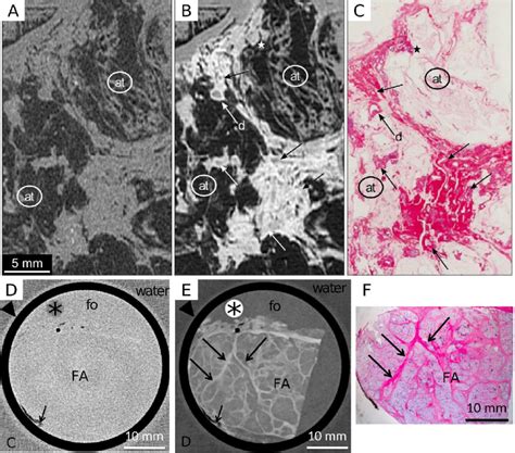 Grating Based Phase Contrast Computed Tomography Examples For Ductal Download Scientific