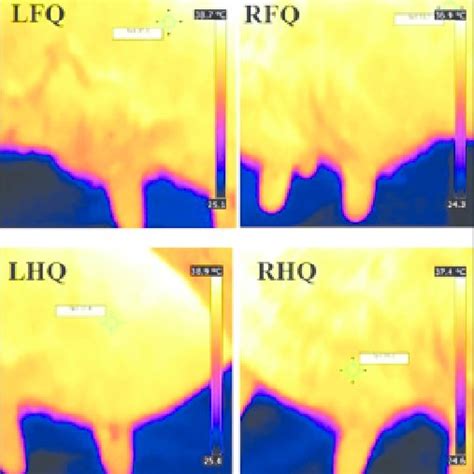 Pdf Infrared Thermography A Potential Noninvasive Tool To Monitor Udder Health Status In