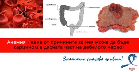 Д р Галин ГАНЧЕВ хирург 2019