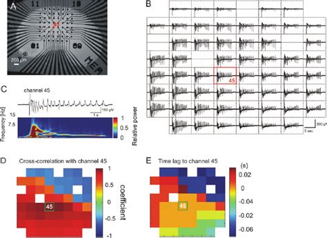 Synchronized Spontaneous Network Activity In Neocortical Slice