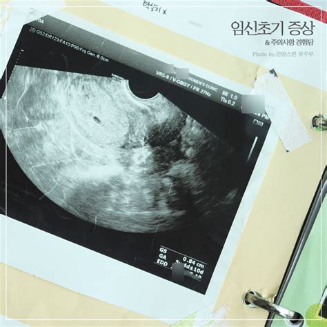 내가 겪은 임신초기 증상 And 주의사항 경험담 네이버 블로그