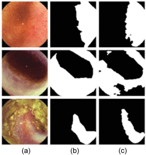 A Review Of Application Of Deep Learning In Endoscopic Image Processing