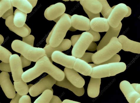 Bifidobacterium Bifidum Stock Image B220 1561 Science Photo Library