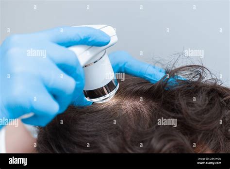 Trichoscopy Of Hair And Scalp Closeup Trichoscope In The Hands Of A