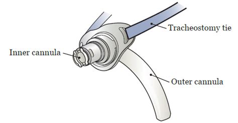 Caring For Your Tracheostomy Memorial Sloan Kettering Cancer Center