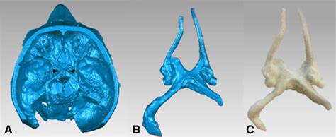A Computational Model Of Dissected Specimen Mp1670 With The Optic Download Scientific Diagram
