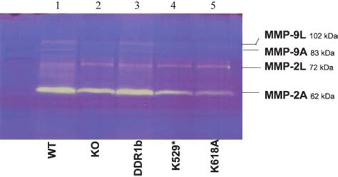 MMP Activity Was Decreased In The DDR1 SMCs And Restored After Download Scientific Diagram