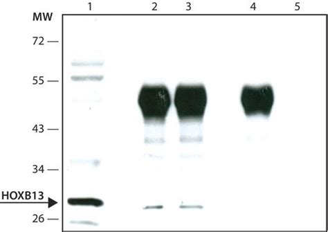 Hoxb13 Antibody Western Immunoprecipitation H1416