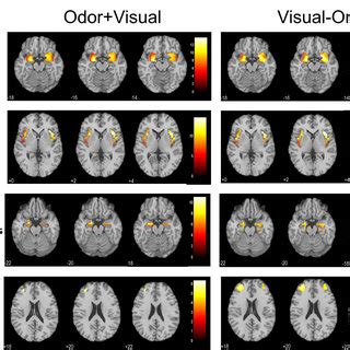 Sex Differences In BOLD Response Primary Olfactory Cortex POC Download Scientific Diagram