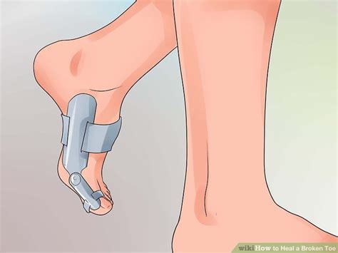 How To Heal A Broken Toe 13 Steps With Pictures WikiHow