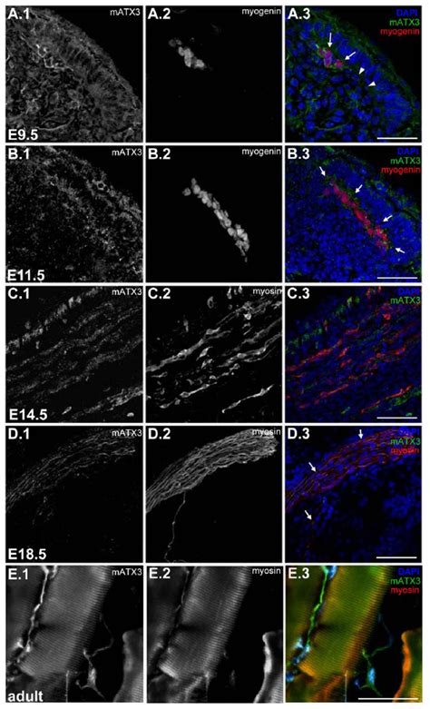 Atxn3 Mgi Mouse Gene Detail Mgi 1099442 Ataxin 3