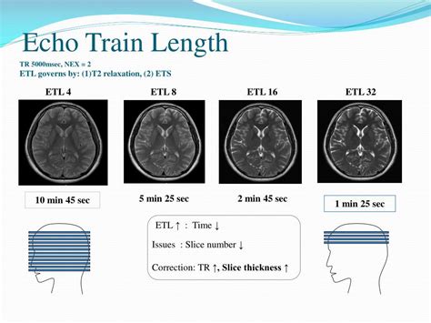 PPT FAST SPIN ECHO PowerPoint Presentation Free Download ID