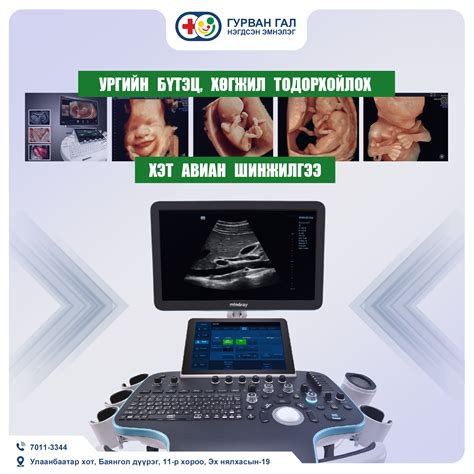 Ургийн хөгжил тодорхойлох хэт авиан шинжилгээ