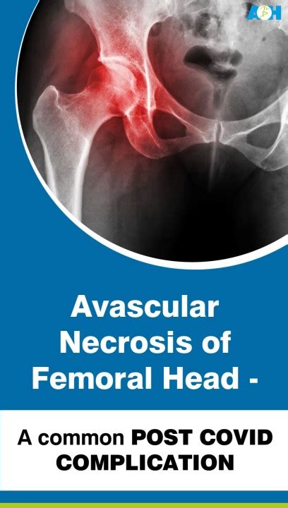 Ashutosh Hospital On Linkedin Core Decompression And Bone Grafting For