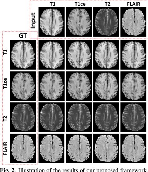 Figure 2 From A Unified Conditional Disentanglement Framework For Multimodal Brain Mr Image