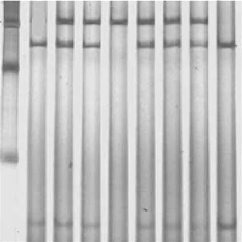 Polymerase Chain Reaction Restriction Fragment Length Polymorphism Download Scientific Diagram