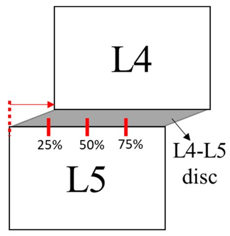 Buu Lspine A Thai Open Lumbar Spine Dataset For Spondylolisthesis