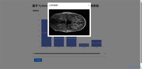 基于 Pywebio 和 Pytorch 的阿尔兹海默智能诊断系统 蓝桥云课