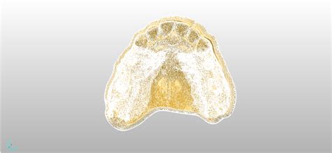 ⚕️ Digital Rpd Model・ Stl File For 3d Printing And Cnc Machining Laser Cutting・cults