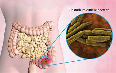 Health Condition Symptoms Causes Treatment And More