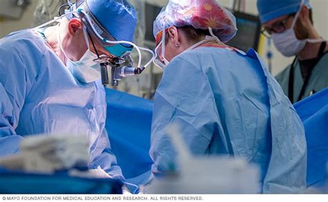 Heart Transplant Mayo Clinic