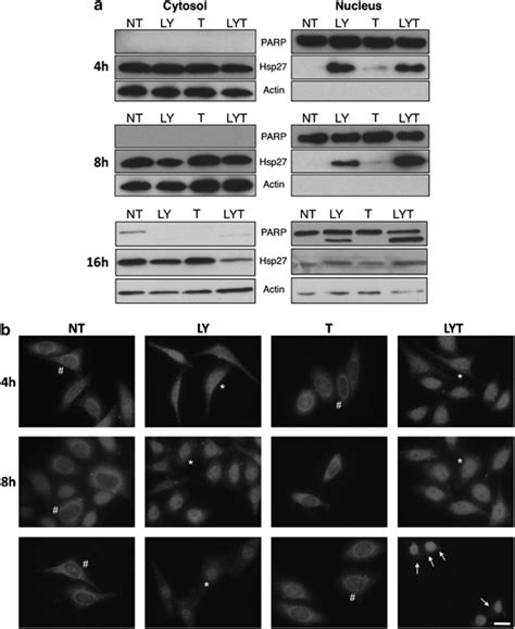 Hsp27 Translocates To The Nucleus A Western Blot Analysis Of Hsp27 Download Scientific