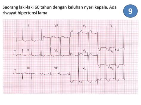 Soal Ujian Ekg Pptx