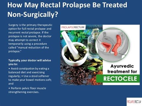 Best Rectal Prolapse Treatment Pptx
