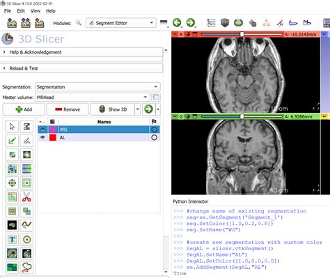 Segment Not Showing Up On The Segment Editor Development 3d Slicer
