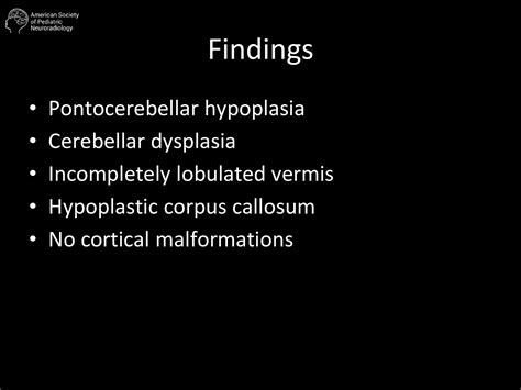 3 Year Old Female With Microcephaly Developmental Delay Dyskinesia Truncal Hypotonia Facial