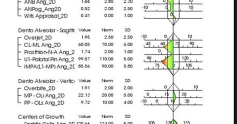How Can I Make A Standard Deviation Chart Similar To This One Imgur