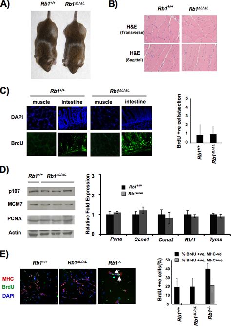 Normal Cell Cycle Exit And Differentiation Of Muscle A Rb1 L L Download Scientific Diagram