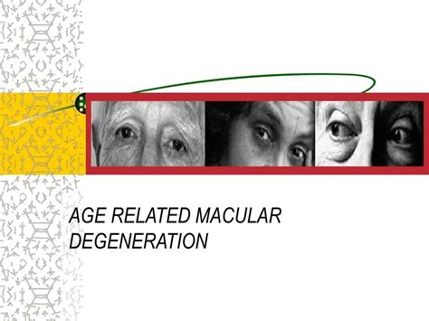 PPT AGE RELATED MACULAR DEGENERATION PowerPoint Presentation Free Download ID 9600244