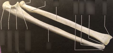 The Ulna Diagram Quizlet