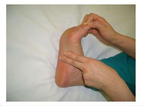 Photograph Of Physical Examination For Plantar Fascia Rupture The Download Scientific Diagram