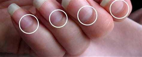 Ulzii 🍊Ёстой мэдмээр юм Хумсны доорхи цагаан толбо ямар учиртай вэ Хүн бүрийн хумсны доод